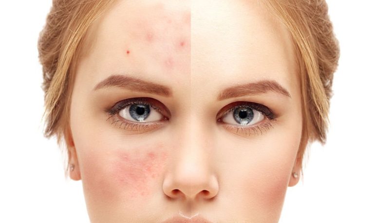 How To Identify And Treat Common Skin Infections | Article Rich